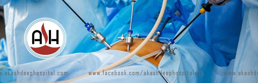 Common Laparoscopic surgeries performed in the hospital are: